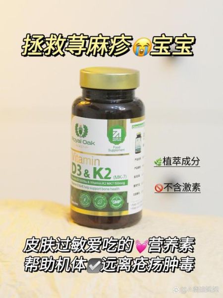 荨麻疹怎么根治_荨麻疹的克星是什么-第1张图片-山城妙识 荨麻疹怎么根治_荨麻疹的克星是什么-第1张图片-山城妙识