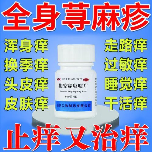 荨麻疹吃什么药止痒最快_荨麻疹止痒药有哪些-第3张图片-山城妙识