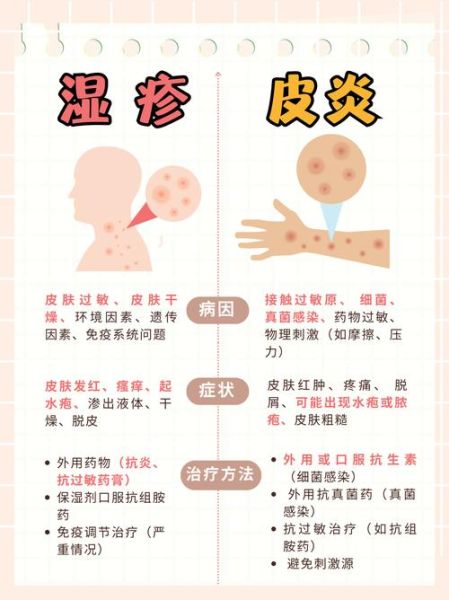 过敏性皮炎湿疹图片_如何辨别症状与类型-第3张图片-山城妙识