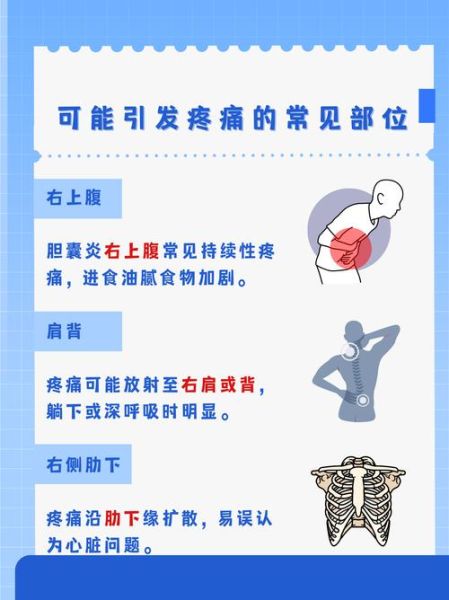 胆囊炎疼痛位置图_胆囊炎疼痛在哪个部位-第1张图片-山城妙识