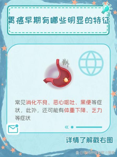 长期消化不良是癌症吗_胃癌早期症状有哪些-第3张图片-山城妙识