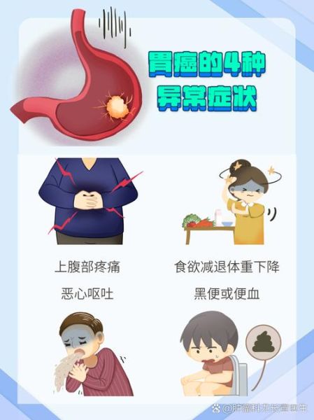 长期消化不良是癌症吗_胃癌早期症状有哪些-第1张图片-山城妙识