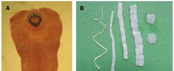 猪肉绦虫图片高清_如何辨别成虫与幼虫-第2张图片-山城妙识