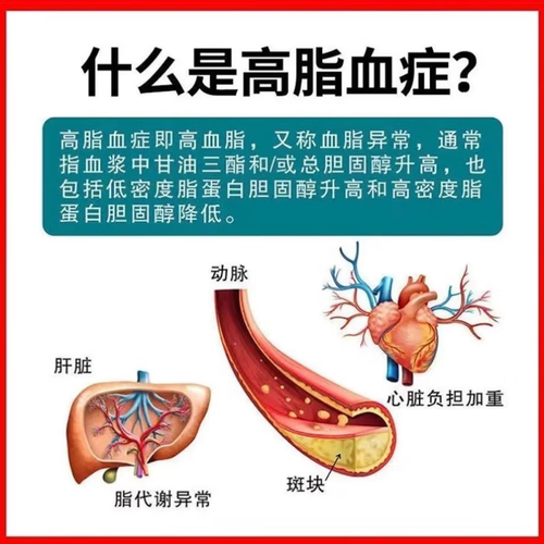 降甘油三酯中成药有哪些_哪种效果最好-第3张图片-山城妙识