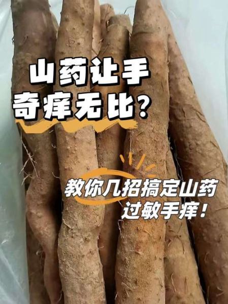 铁棍山药痒怎么快速止痒_手痒怎么办-第2张图片-山城妙识 铁棍山药痒怎么快速止痒_手痒怎么办-第2张图片-山城妙识