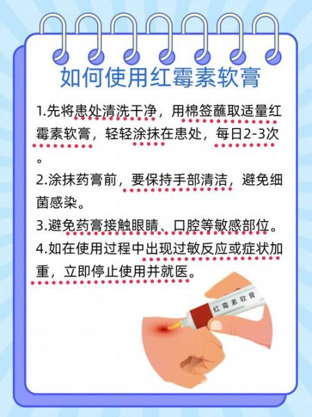 红霉素软膏能涂痘痘吗_红霉素软膏的作用和禁忌-第1张图片-山城妙识