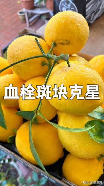 血栓吃什么食物好_血栓最怕的三种食物-第1张图片-山城妙识