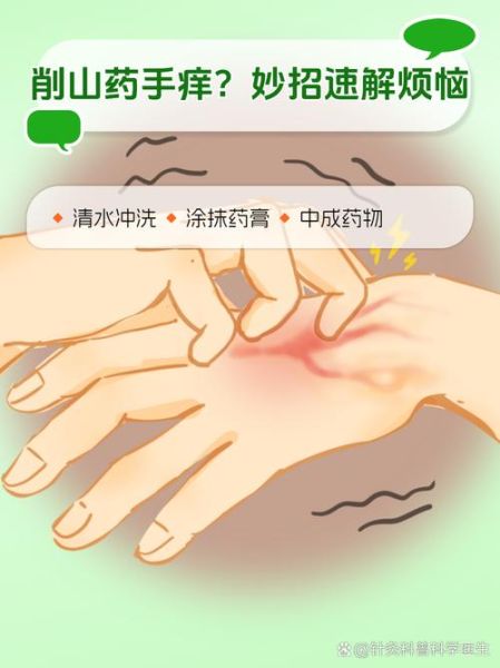 山药皮痒怎么办_快速止痒方法-第3张图片-山城妙识