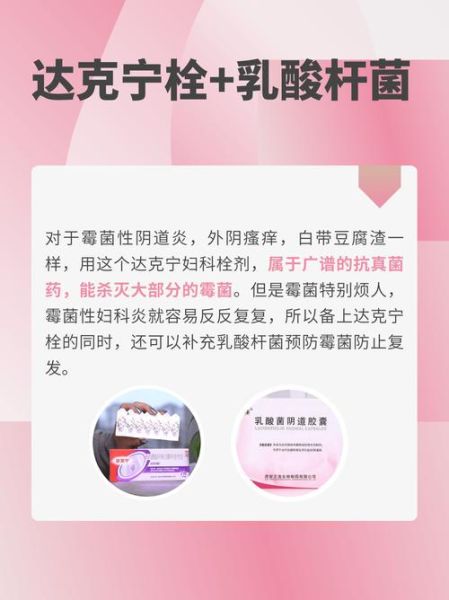 豆腐渣样白带瘙痒用什么药_霉菌性阴道炎治疗-第2张图片-山城妙识