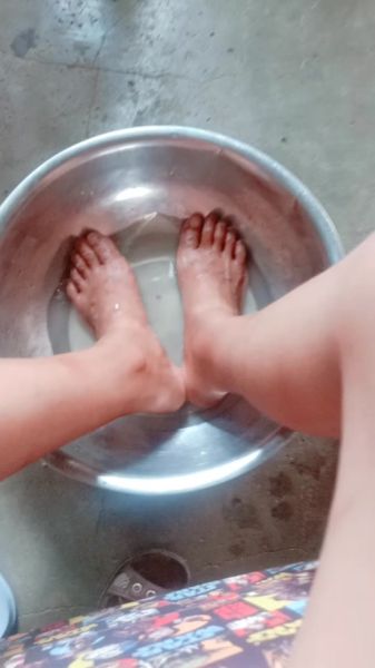 醋精泡脚的正确使用方法_醋精泡脚用多少度水-第3张图片-山城妙识