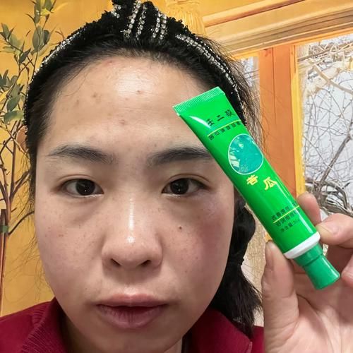 苦瓜汁敷脸可以祛痘吗_苦瓜汁祛痘效果怎么样-第2张图片-山城妙识