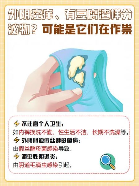 轻微豆腐渣样白带图片_是什么原因-第2张图片-山城妙识 轻微豆腐渣样白带图片_是什么原因-第2张图片-山城妙识