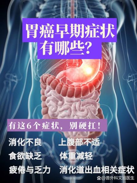 饭后两个症状胃癌来了_是真是假-第1张图片-山城妙识