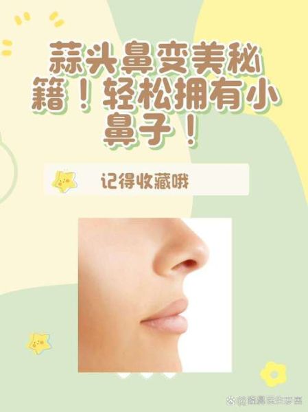 蒜头鼻怎么改善_蒜头鼻怎么自然变小-第1张图片-山城妙识