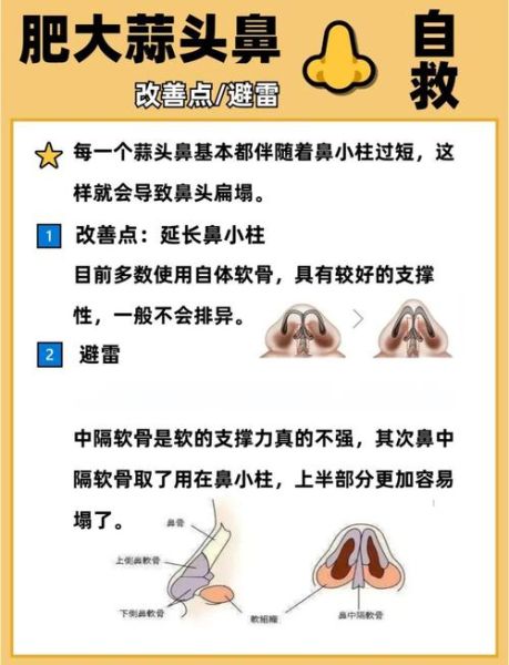 蒜头鼻怎么改善_蒜头鼻怎么自然变小-第2张图片-山城妙识