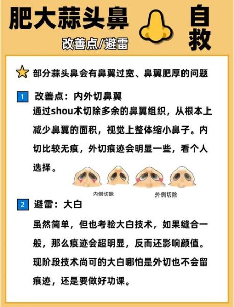 蒜头鼻怎么改善_蒜头鼻怎么自然变小-第3张图片-山城妙识