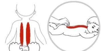 蚂蚁上树按摩是什么_捏脊手法怎么做-第2张图片-山城妙识
