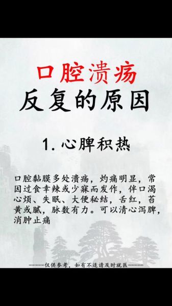 口腔溃疡反复发作是什么原因_怎么根治-第2张图片-山城妙识 口腔溃疡反复发作是什么原因_怎么根治-第2张图片-山城妙识