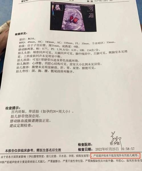 b超有两点基本是男孩_准确率有多高-第2张图片-山城妙识 b超有两点基本是男孩_准确率有多高-第2张图片-山城妙识