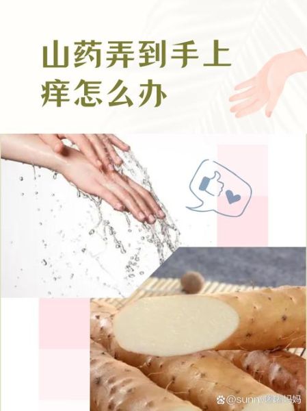 山药弄到手上很痒怎么办_山药手痒快速止痒方法-第1张图片-山城妙识