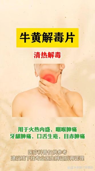去火的药有哪些_上火吃什么药见效快-第2张图片-山城妙识