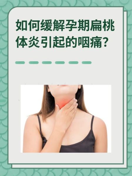 孕妇扁桃体发炎怎么办_孕妇扁桃体发炎小妙招-第3张图片-山城妙识 孕妇扁桃体发炎怎么办_孕妇扁桃体发炎小妙招-第3张图片-山城妙识