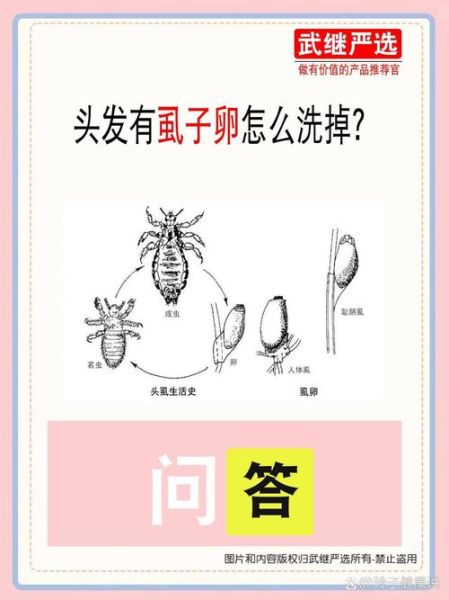 虱子怎么彻底去除_虱子卵如何识别-第1张图片-山城妙识 虱子怎么彻底去除_虱子卵如何识别-第1张图片-山城妙识