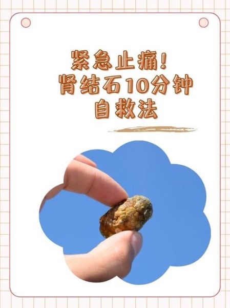 结石疼痛怎么快速止痛_肾结石发作缓解方法-第1张图片-山城妙识