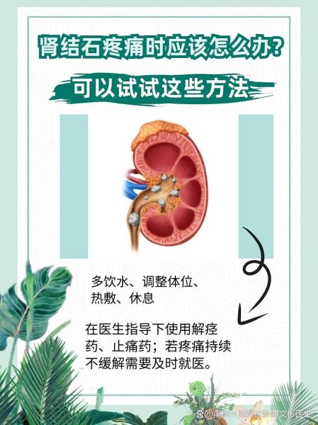 结石疼痛怎么快速止痛_肾结石发作缓解方法-第2张图片-山城妙识