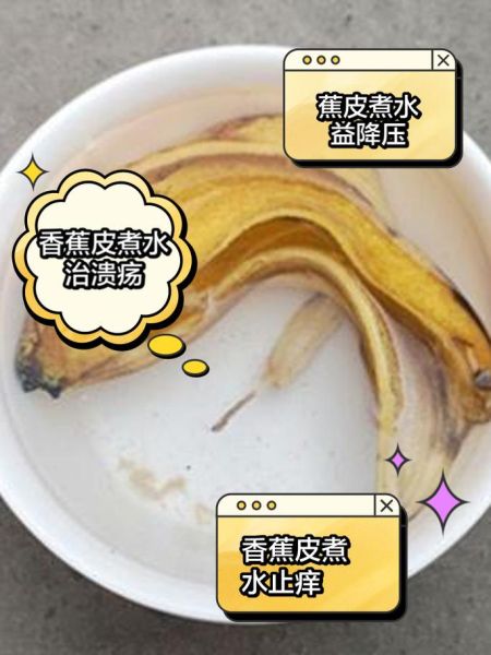 香蕉皮煮水有什么功效_香蕉皮煮水可以减肥吗-第1张图片-山城妙识 香蕉皮煮水有什么功效_香蕉皮煮水可以减肥吗-第1张图片-山城妙识
