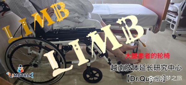 增高手术后悔了怎么办_增高手术失败怎么补救-第3张图片-山城妙识 增高手术后悔了怎么办_增高手术失败怎么补救-第3张图片-山城妙识