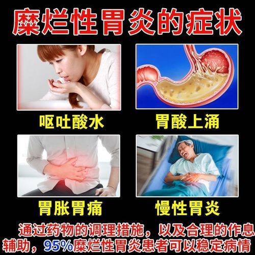 糜烂性胃炎吃什么药_糜烂性胃炎吃什么药好得快-第3张图片-山城妙识