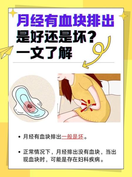 女性活血化瘀最有效的办法_经期血块怎么快速排出-第1张图片-山城妙识 女性活血化瘀最有效的办法_经期血块怎么快速排出-第1张图片-山城妙识