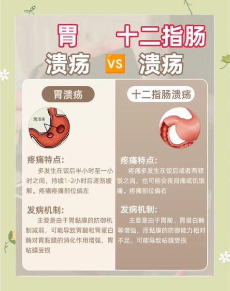 胃糜烂和胃溃疡哪个严重_区别与后果-第1张图片-山城妙识 胃糜烂和胃溃疡哪个严重_区别与后果-第1张图片-山城妙识