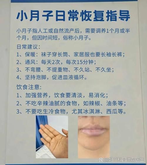 小月子流产休息多少天_流产后多久能上班-第1张图片-山城妙识 小月子流产休息多少天_流产后多久能上班-第1张图片-山城妙识