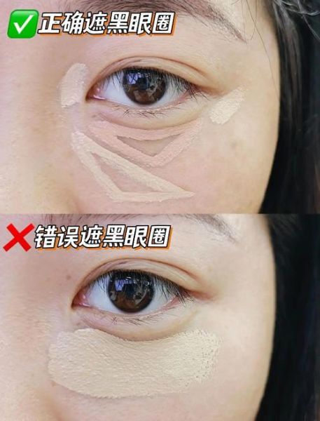 怎么去黑眼圈最快_黑眼圈怎么消除最有效-第2张图片-山城妙识 怎么去黑眼圈最快_黑眼圈怎么消除最有效-第2张图片-山城妙识