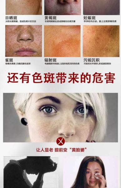 快速祛斑产品哪个好_多久见效-第2张图片-山城妙识