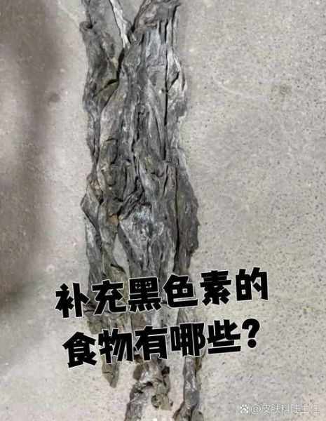 黑色素缺失吃什么补充最快_吃什么食物补黑色素最有效-第3张图片-山城妙识