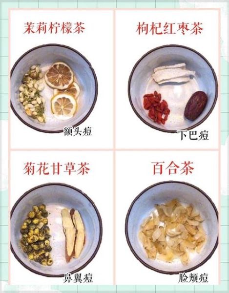 祛痘方法小妙招_如何快速祛痘不留印-第1张图片-山城妙识