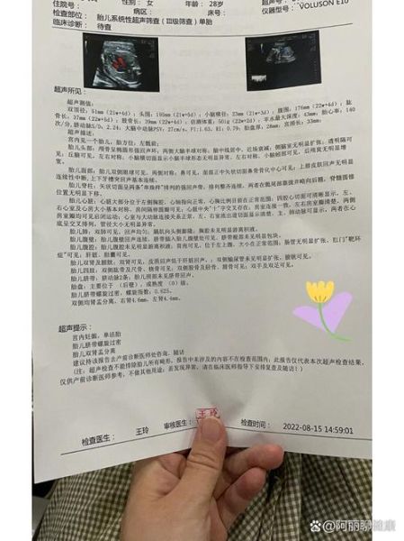 大排畸多少周做_大排畸检查最佳时间-第1张图片-山城妙识 大排畸多少周做_大排畸检查最佳时间-第1张图片-山城妙识