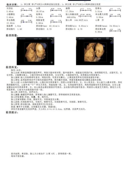 大排畸多少周做_大排畸检查最佳时间-第2张图片-山城妙识 大排畸多少周做_大排畸检查最佳时间-第2张图片-山城妙识