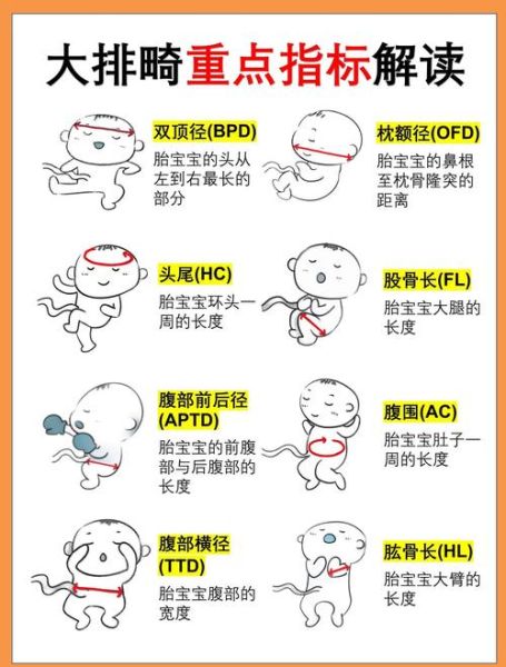 大排畸多少周做_大排畸检查最佳时间-第3张图片-山城妙识 大排畸多少周做_大排畸检查最佳时间-第3张图片-山城妙识