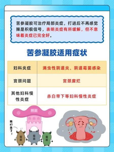 苦参凝胶的功效与作用_苦参凝胶能治疗哪些妇科病-第1张图片-山城妙识 苦参凝胶的功效与作用_苦参凝胶能治疗哪些妇科病-第1张图片-山城妙识