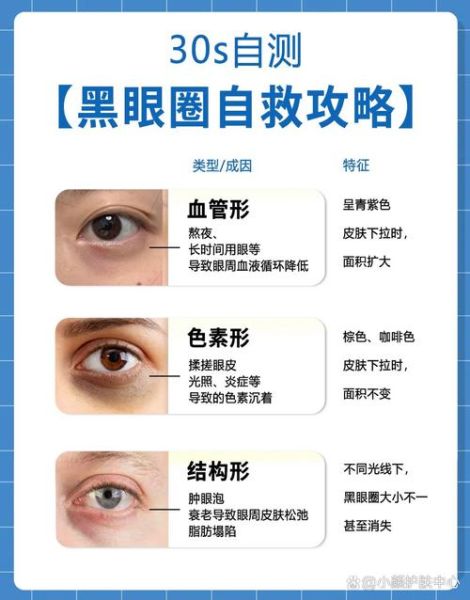 黑眼圈重怎么快速消除_熬夜后去黑眼圈最有效的方法-第1张图片-山城妙识 黑眼圈重怎么快速消除_熬夜后去黑眼圈最有效的方法-第1张图片-山城妙识