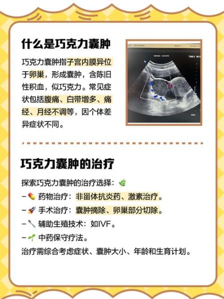 巧克力囊肿术后多久能怀孕_术后怀孕最佳时间-第1张图片-山城妙识 巧克力囊肿术后多久能怀孕_术后怀孕最佳时间-第1张图片-山城妙识