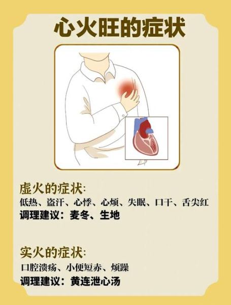烧心是什么病的前兆_经常烧心警惕哪些疾病-第3张图片-山城妙识