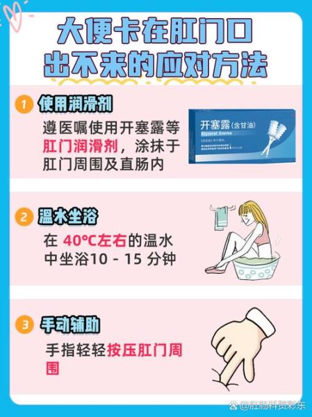 便秘粑粑堵在肛门怎么办_快速通便绝招-第2张图片-山城妙识 便秘粑粑堵在肛门怎么办_快速通便绝招-第2张图片-山城妙识