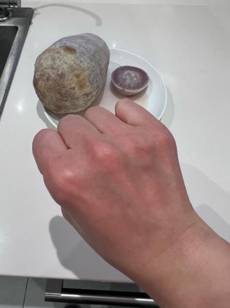 弄完芋头手痒怎么办_芋头手痒快速止痒方法-第1张图片-山城妙识 弄完芋头手痒怎么办_芋头手痒快速止痒方法-第1张图片-山城妙识