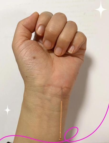 瓜蒌薤白半夏汤治什么病_瓜蒌薤白半夏汤功效与作用-第3张图片-山城妙识 瓜蒌薤白半夏汤治什么病_瓜蒌薤白半夏汤功效与作用-第3张图片-山城妙识