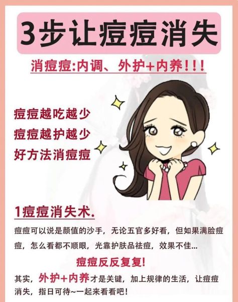 如何祛痘最有效_祛痘小妙招有哪些-第1张图片-山城妙识 如何祛痘最有效_祛痘小妙招有哪些-第1张图片-山城妙识